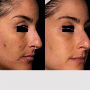 Skin Maintenance Gallery - Dr Davin Lim