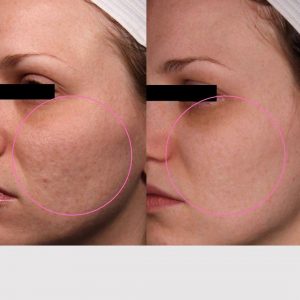 Skin Maintenance Gallery - Dr Davin Lim