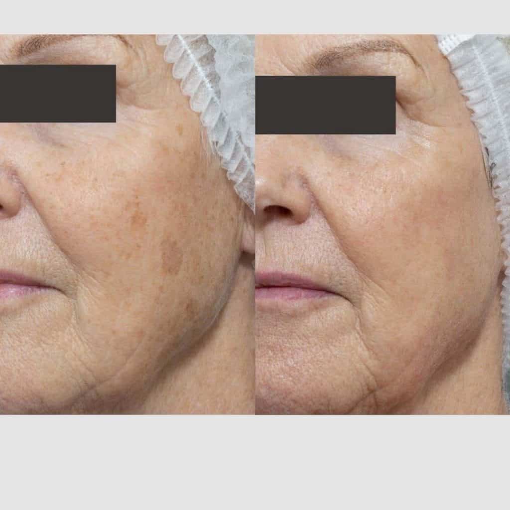 Skin Maintenance Gallery - Dr Davin Lim