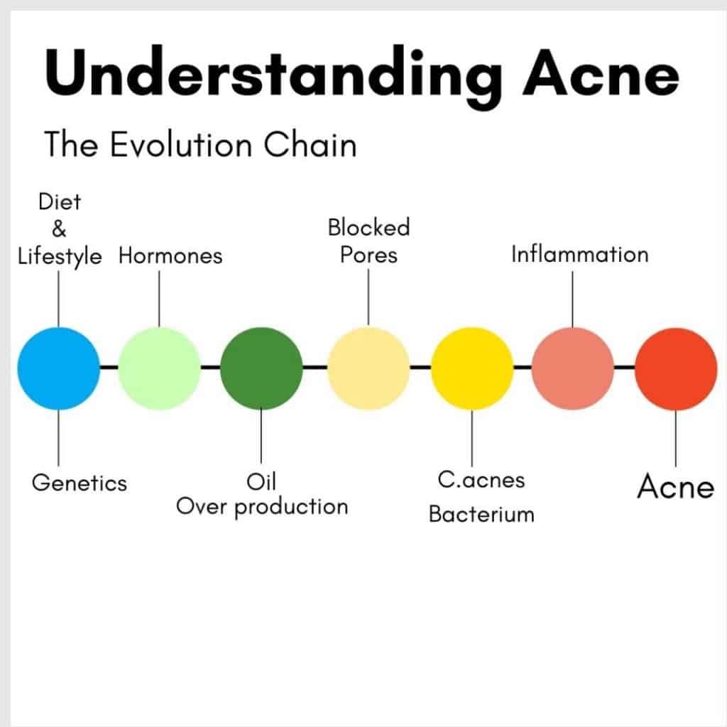 Acne Treatments Gallery - Dr Davin Lim