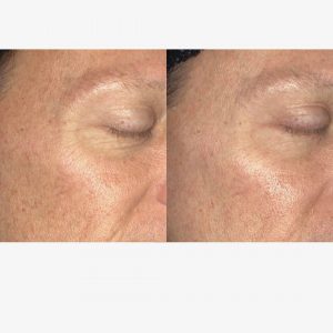 Skin Care: Anti-Aging Gallery - Dr Davin Lim