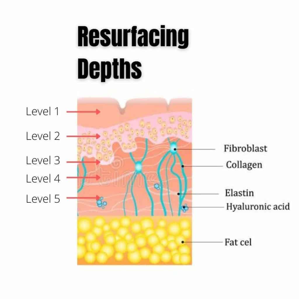 Laser Resurfacing Gallery - Dr Davin Lim