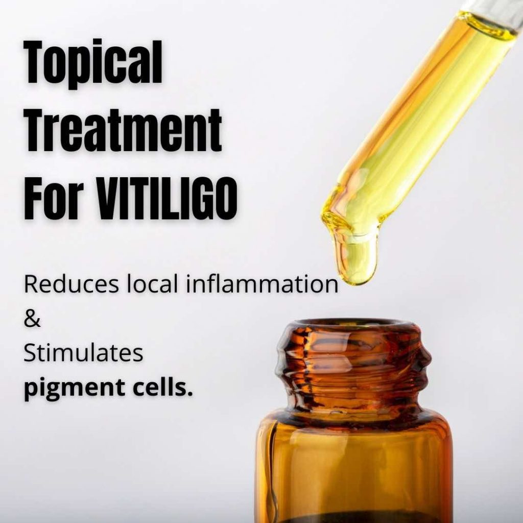 Vitiligo- Depigmentation - Dr Davin Lim