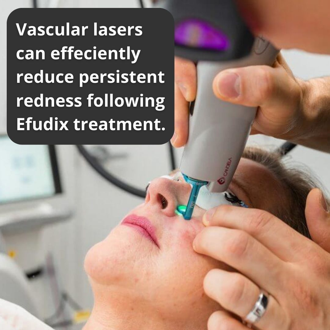 Best Efudix For Sun Spots Treatment In Brisbane | Dr Davin Lim
