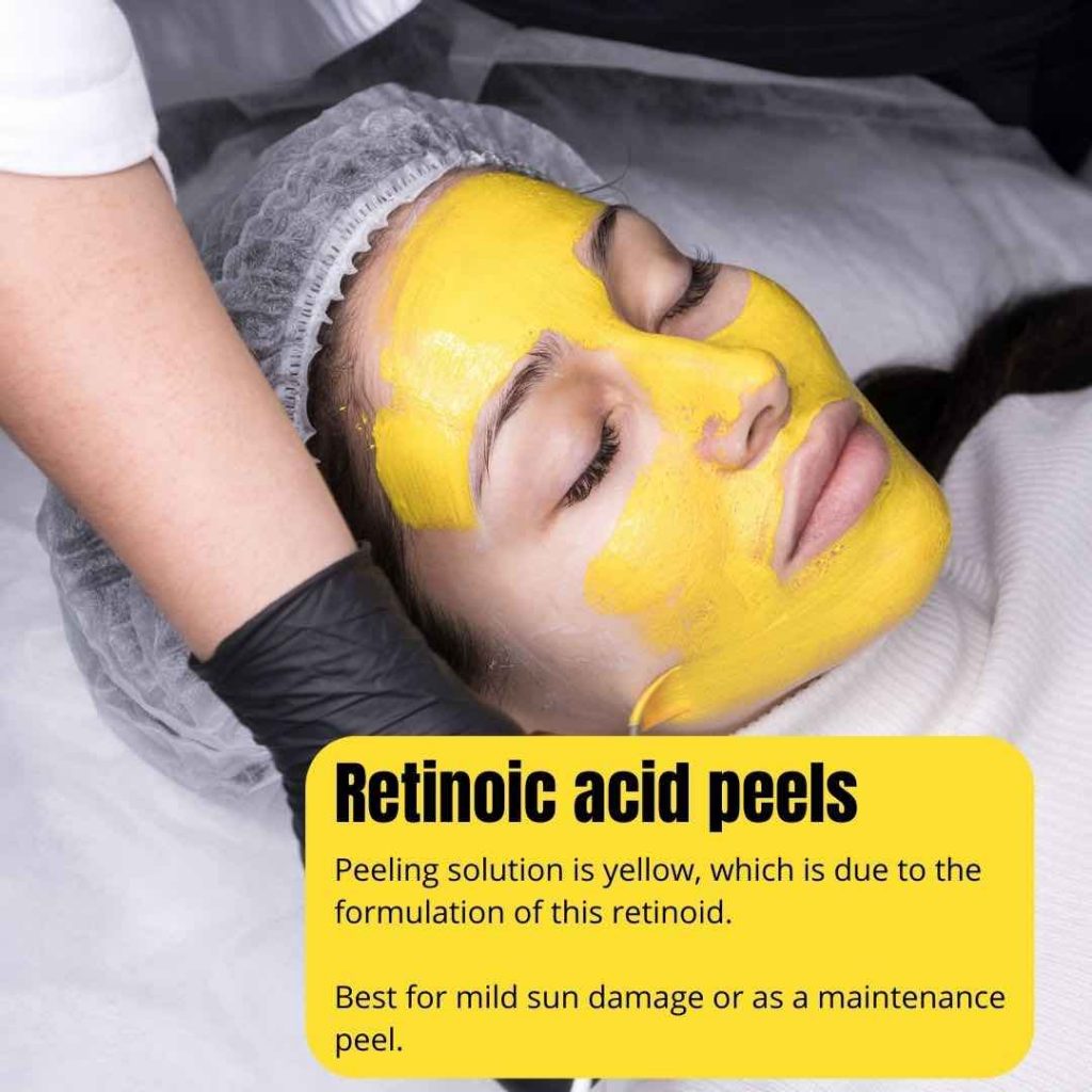 Chemical Peels For Sunspots - Dr Davin Lim