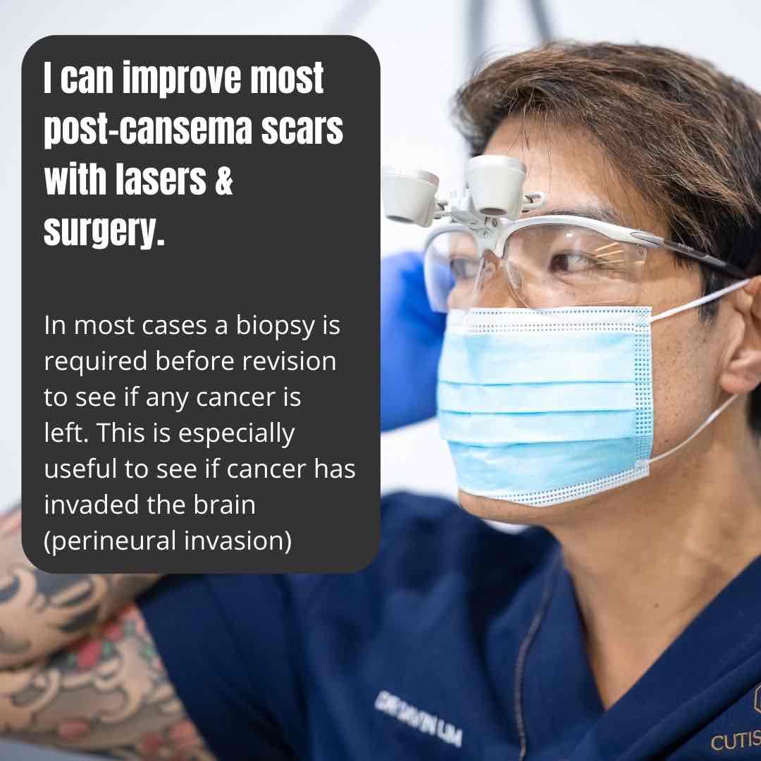 Cansema / Black Salve For Sunspots - Dr Davin Lim