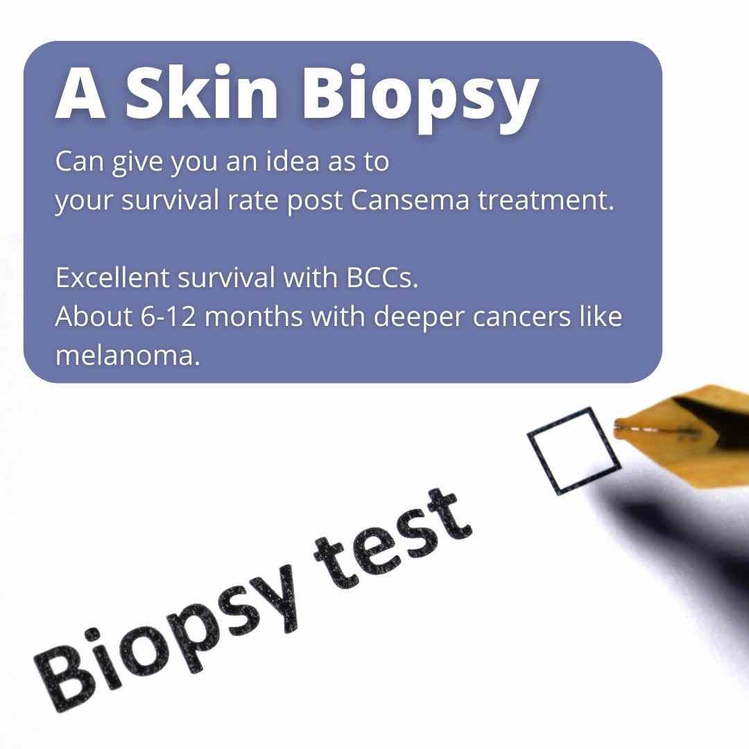 Best Cansema Treatment