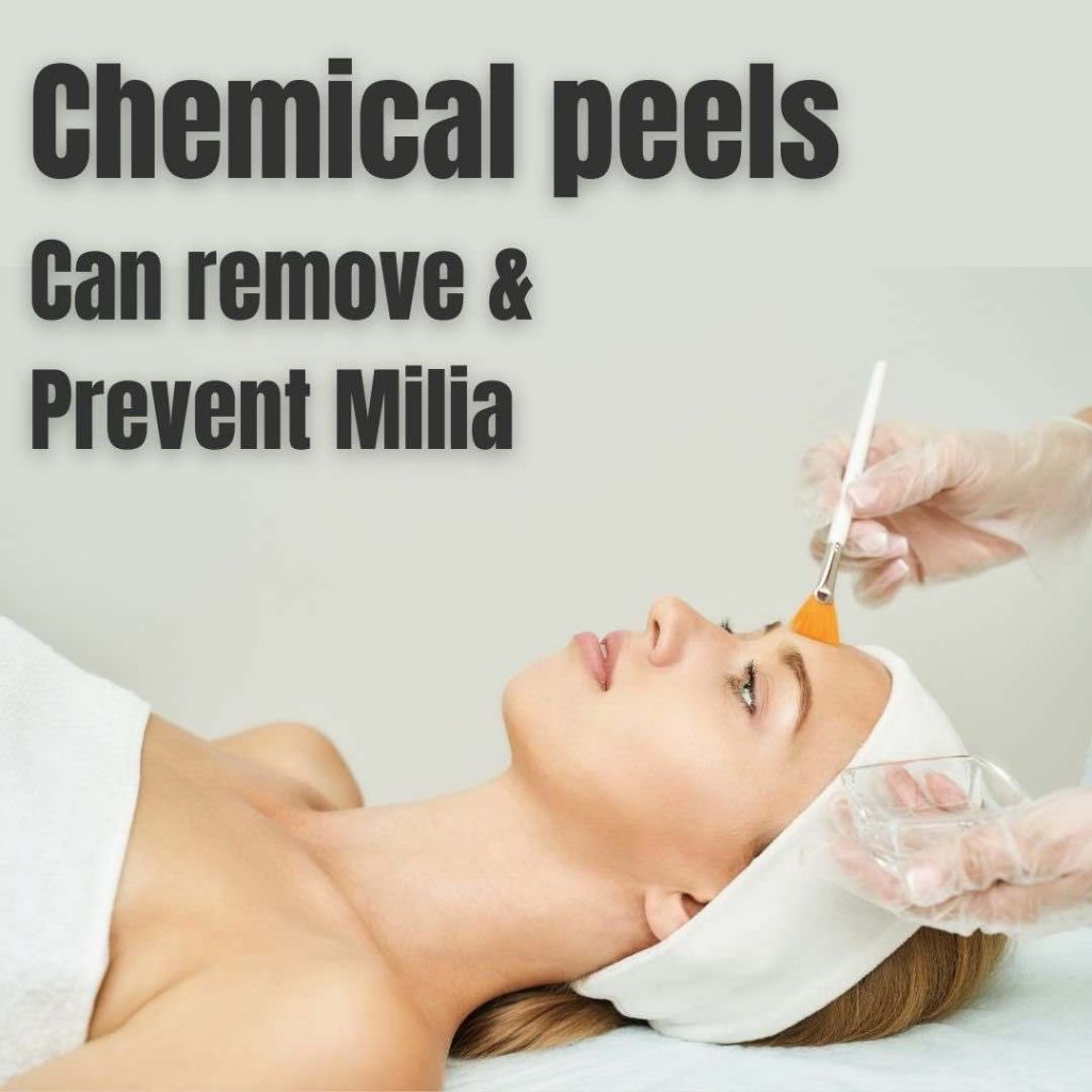 Best Milia Treatments In Australia 2026 | Dr Davin Lim