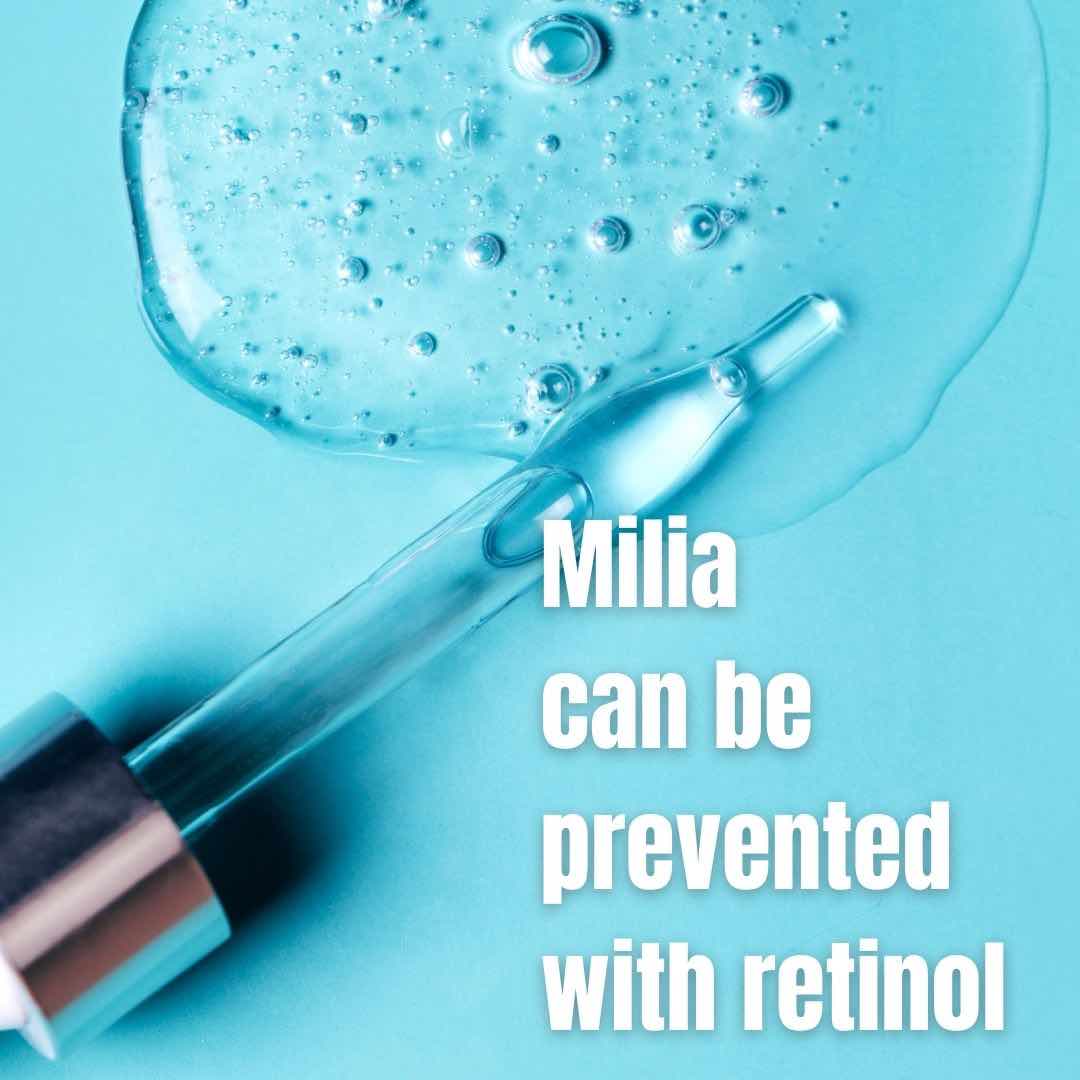 Best Milia Treatments In Australia 2026 | Dr Davin Lim