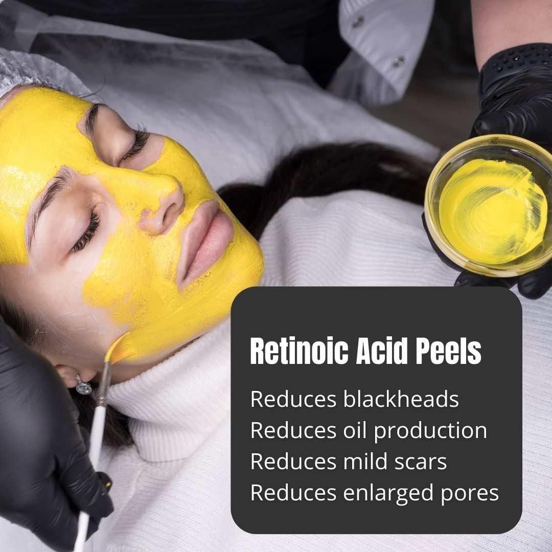 Best Creams For Treating Acne In Australia | Dr Davin Lim