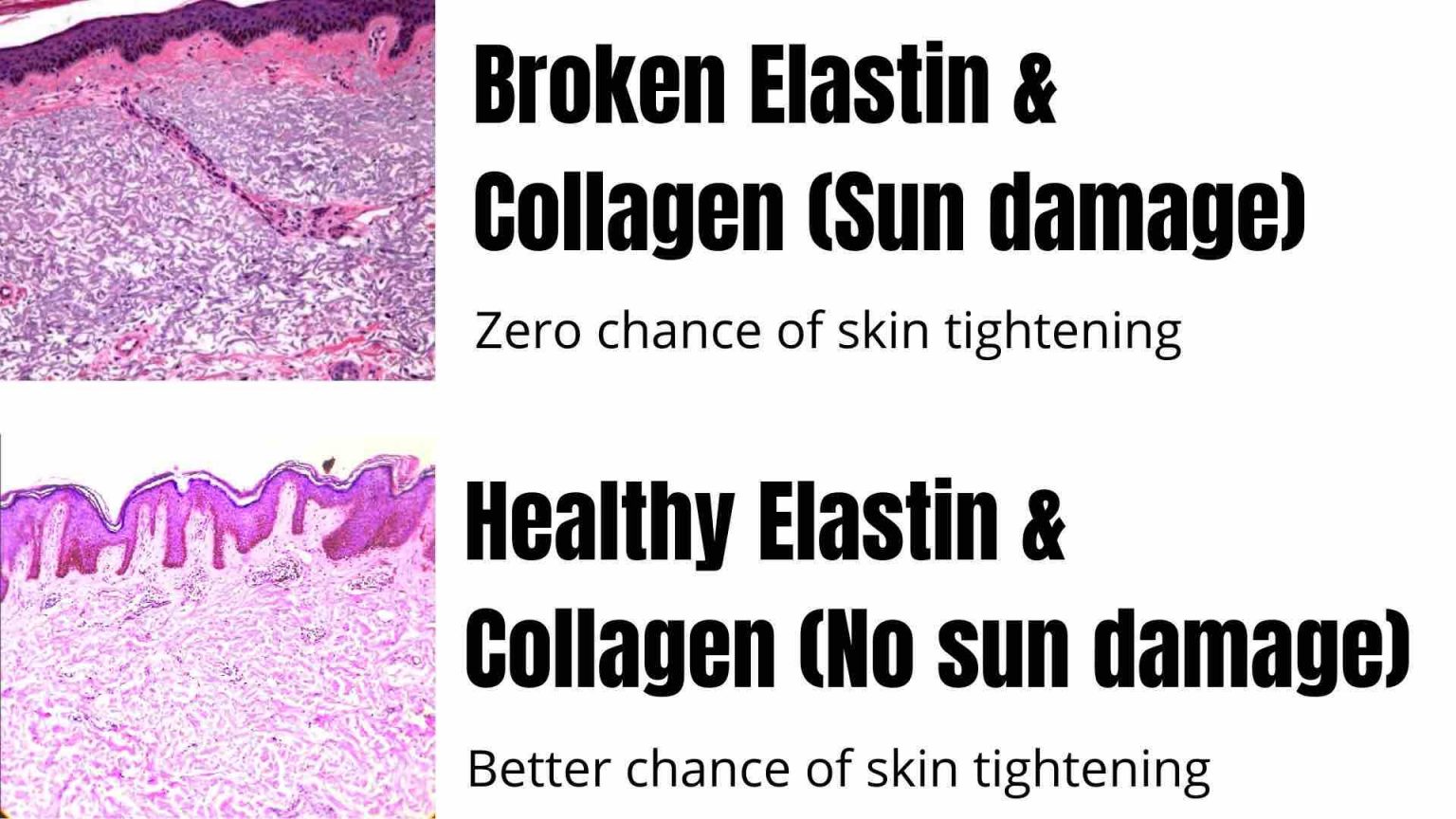 Best Ultherapy Treatments In Australia | Dr Davin Lim