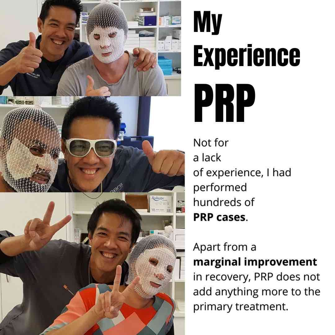 PRP Platelet Rich Plasma - Dr Davin Lim