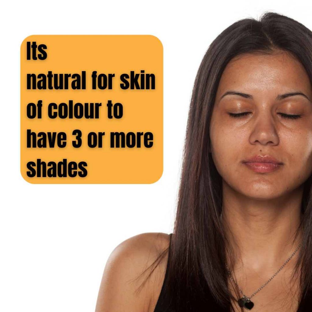 Best Skin Lightening Treatments In Australia | Dr Davin Lim