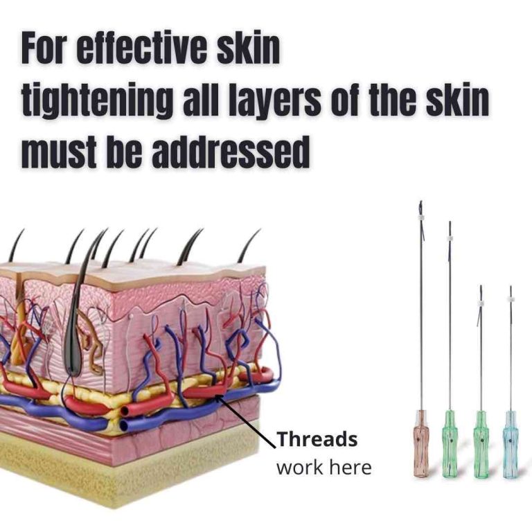 Skin Tightening Essentials. What You Need To Know.