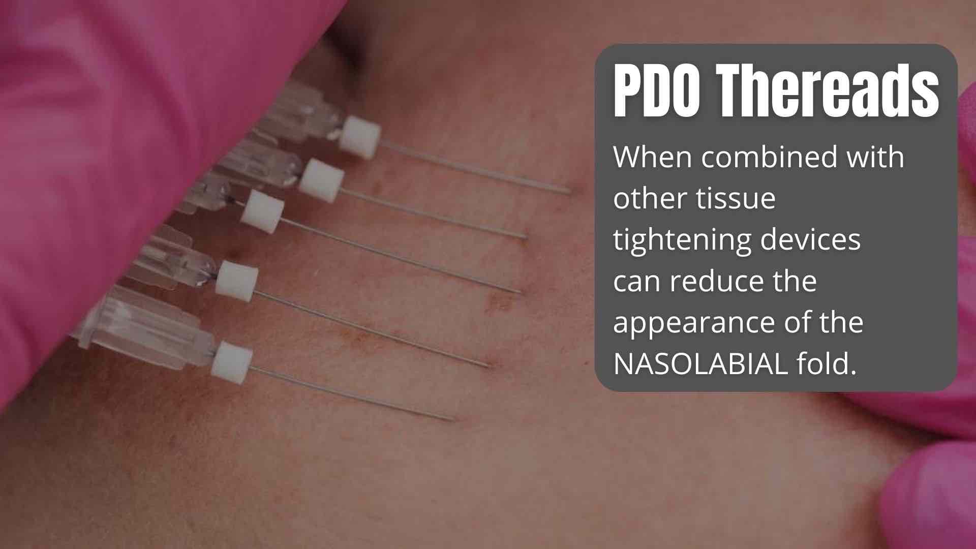 Wrinkles Perioral / Mouth - Dr Davin Lim