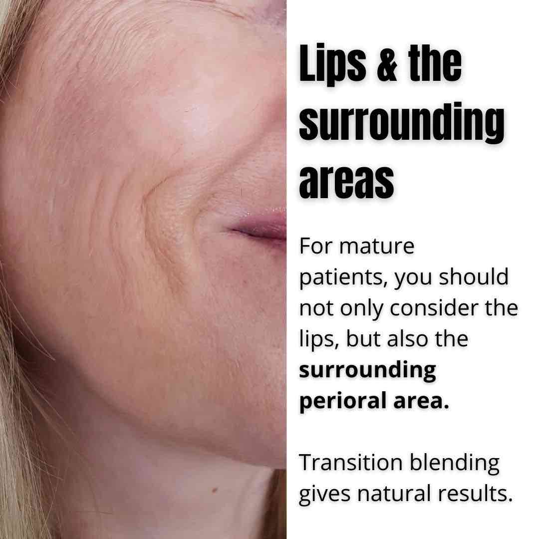 Wrinkles Perioral / Mouth - Dr Davin Lim