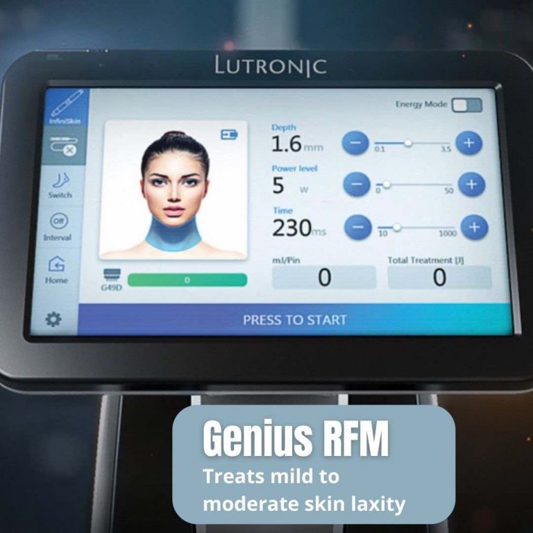 Profound RF Microneedling - Dr Davin Lim