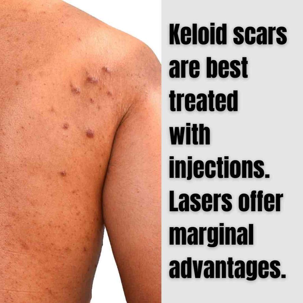 Keloid Scars | Best Treatment In Brisbane - Dr Davin Lim
