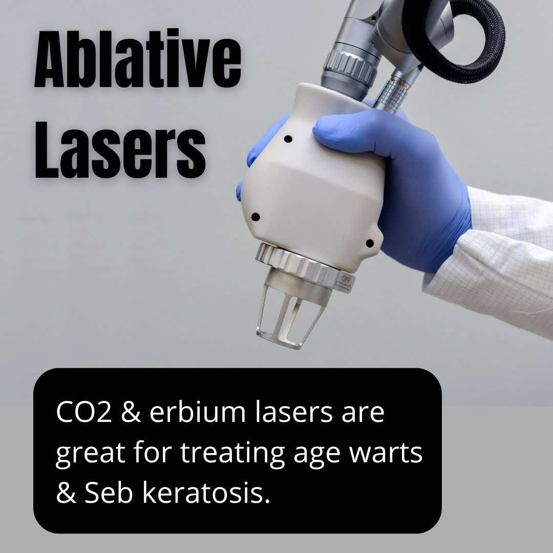 Age Warts - Seborrhoeic Keratosis - Dr Davin Lim