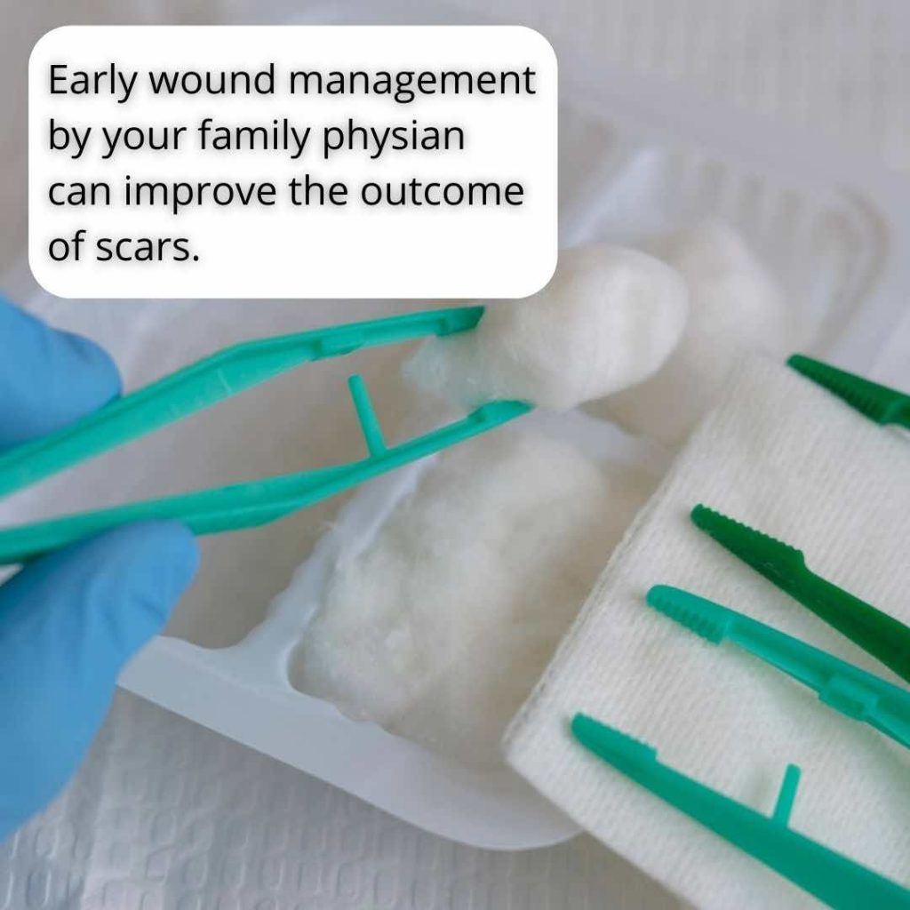 Self-Harm / Cutting Scars - Immediate Treatment - Dr Davin Lim