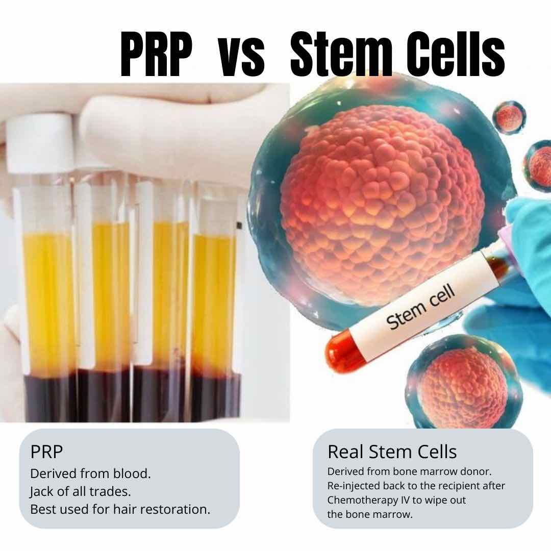Stem Cell Therapy - Dr Davin Lim