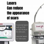 Chicken Pox Scars - Dr Davin Lim | Dermatologist