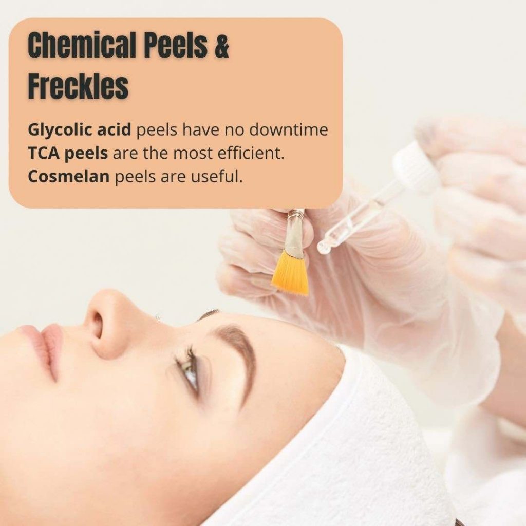 Best Freckle Treatments In Brisbane 2025 | Dr Davin Lim