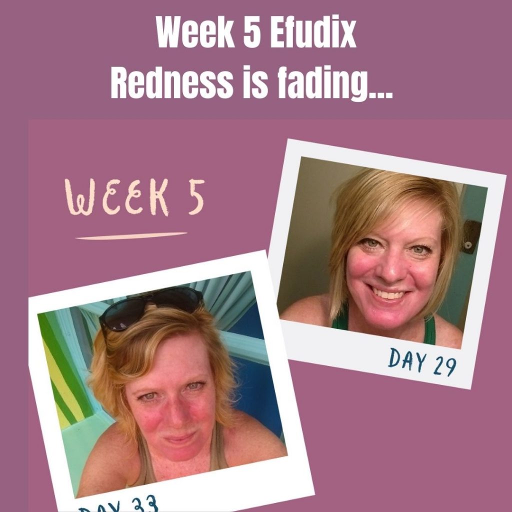 Best Efudix For Sun Spots Treatment In Brisbane | Dr Davin Lim