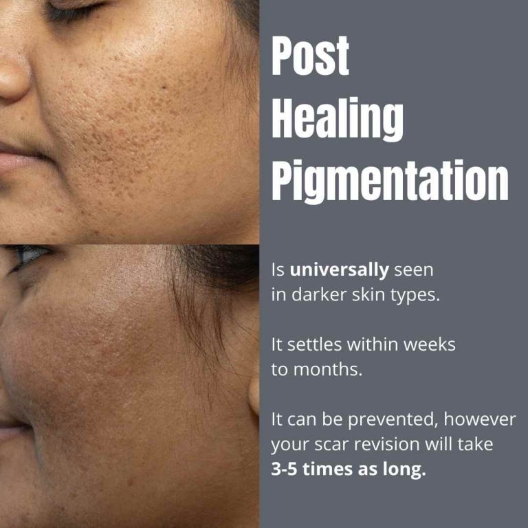 Tranexamic Acid - Dr Davin Lim | Dermatologist Explains