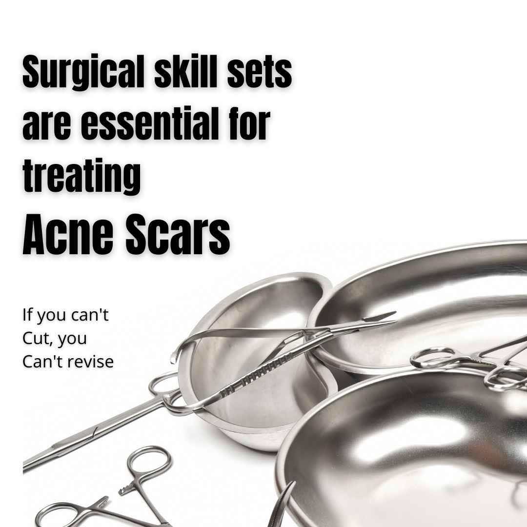 Surgery For Acne Scars - Dr Davin Lim