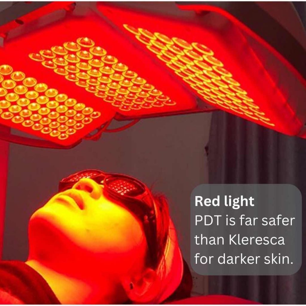 Kleresca Acne Treatments - Dr Davin Lim