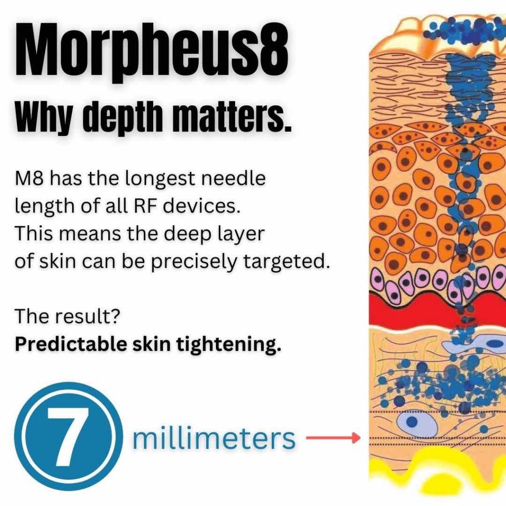Best Morpheus 8 RF Microneedling In Brisbane | Dr Davin Lim