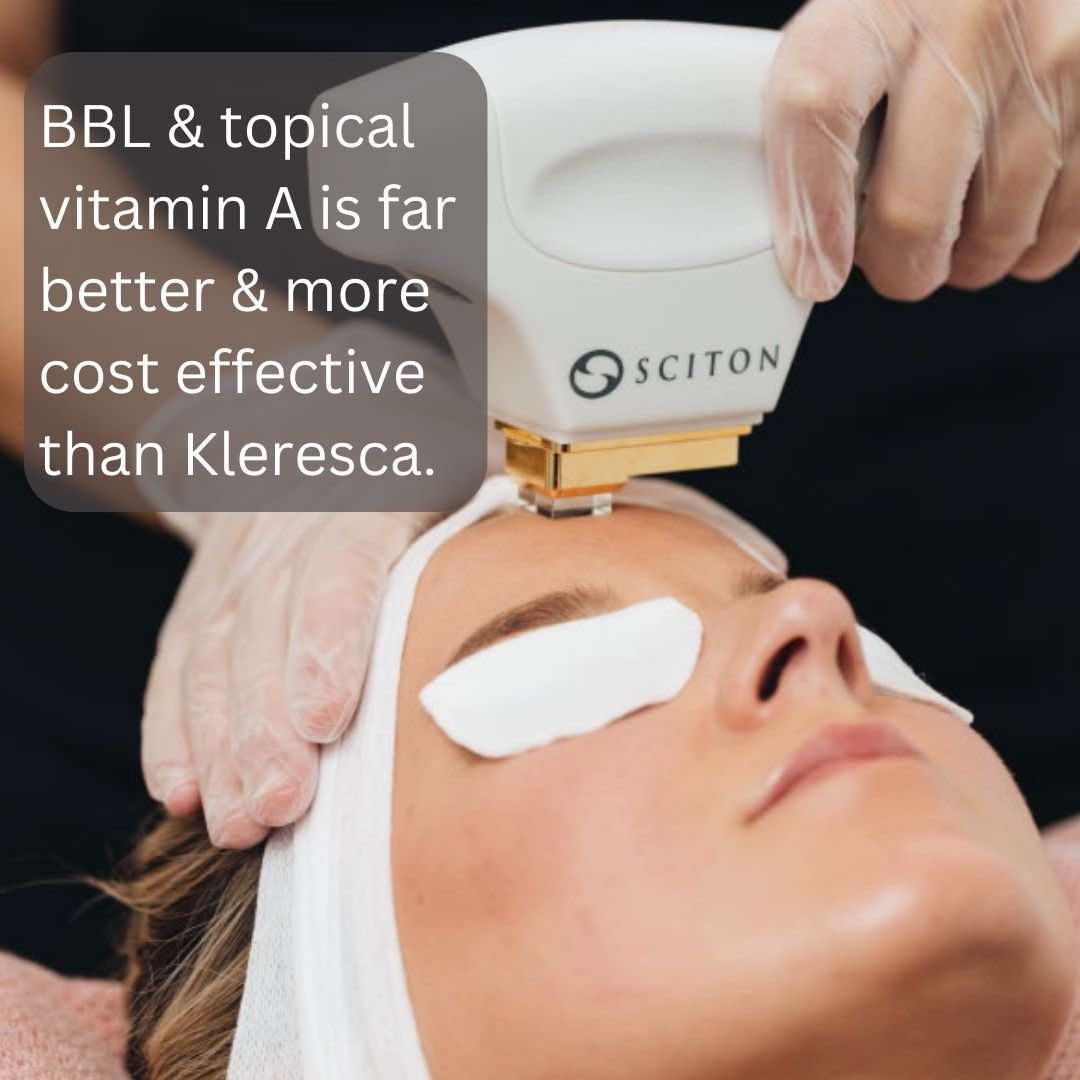 Kleresca Acne Treatments - Dr Davin Lim