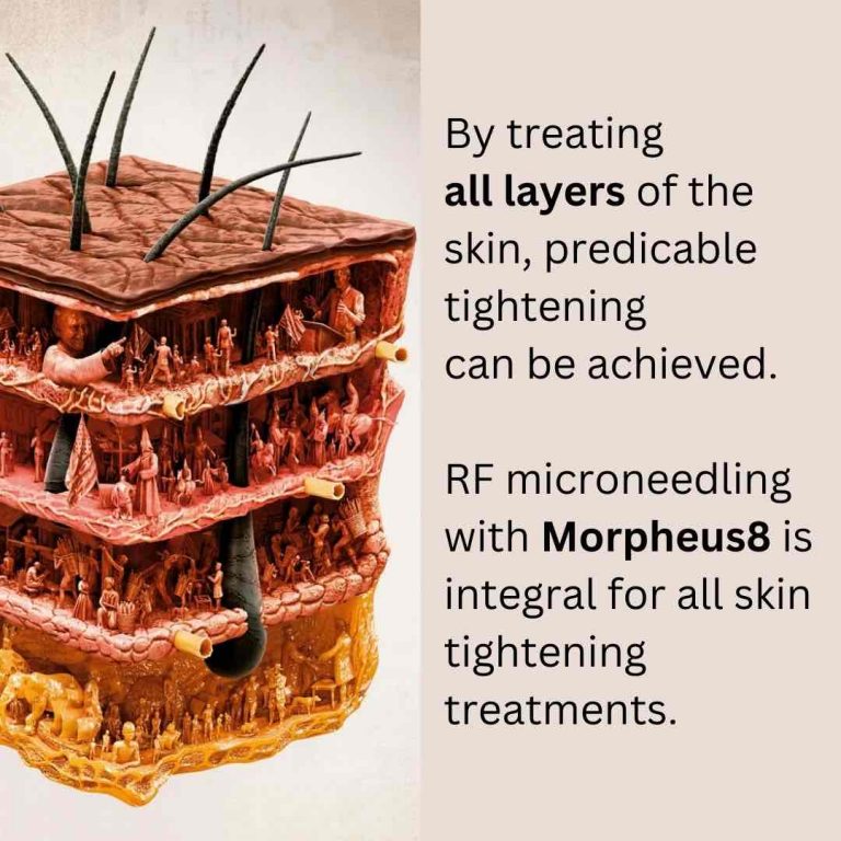 Best Morpheus 8 RF Microneedling In Brisbane | Dr Davin Lim