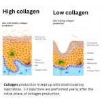 BIOSTIMULATOR INJECTIONS: Complete 2023 Guide - Dr Davin Lim
