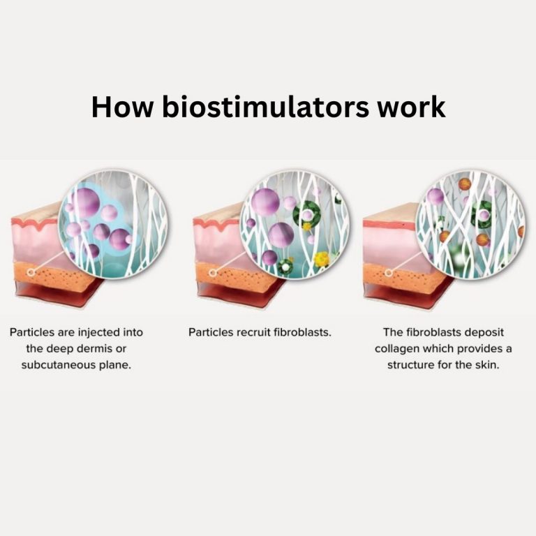 BIOSTIMULATOR INJECTIONS: Complete 2023 Guide - Dr Davin Lim