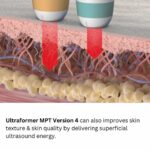Ultraformer MPT: Unparalleled 2025 Skin Tightening Australia - Dr Davin Lim