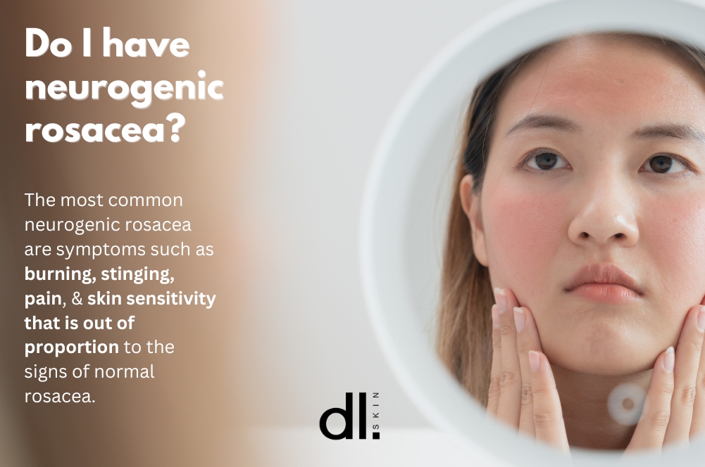 Best Neurogenic Rosacea Treatments In Australia 2026